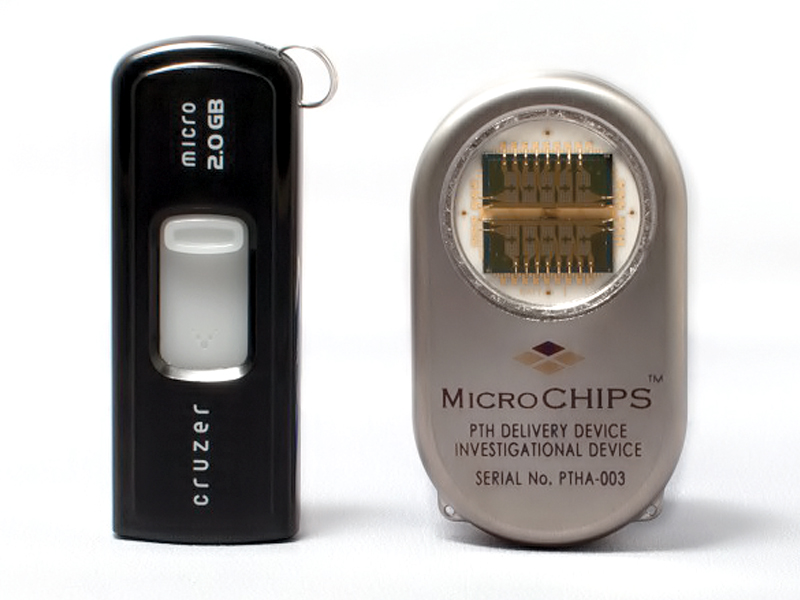 Scientists report success in first human tests of drug-delivery chip